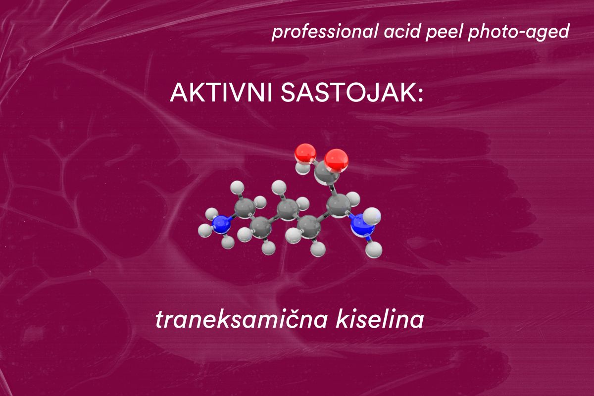 AHA kiseline iz REVIDERMA - Sasvim novo viđenje kiselina - Reviderm